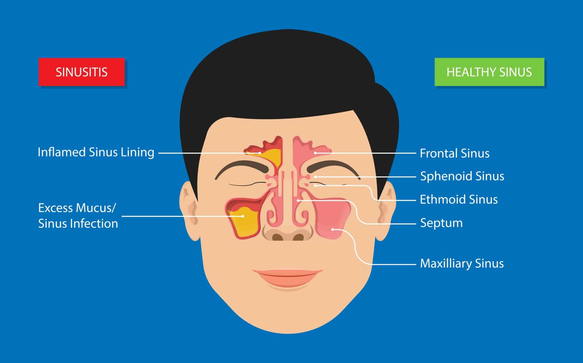 Treatment Options Las Vegas NV - Sinus Treatment Las Vegas